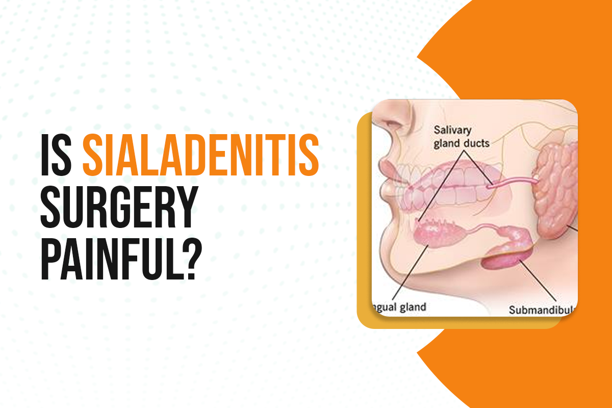 Is Sialadenitis Surgery Painful? | Dr. Sudarshen Aahire